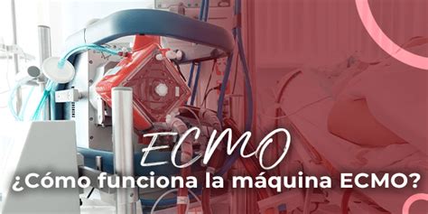 ¿qué Es Ecmo Y Para Qué Sirve Universidad Santa Paula