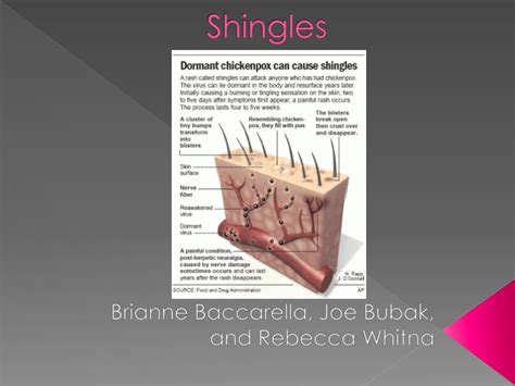 Ppt Shingles Powerpoint Presentation Free Download Id2643397