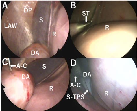 Figure 1 From One Step Laparoscopic Abomasopexy For Left Displacements