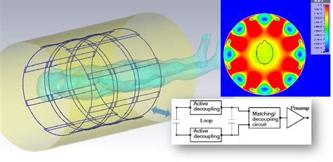 Figure 1 From Design Of A Cryogenic Rf Coil Prototype For A Full Body 1