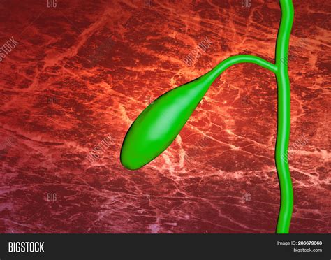 Enlarged Gallbladder Image And Photo Free Trial Bigstock