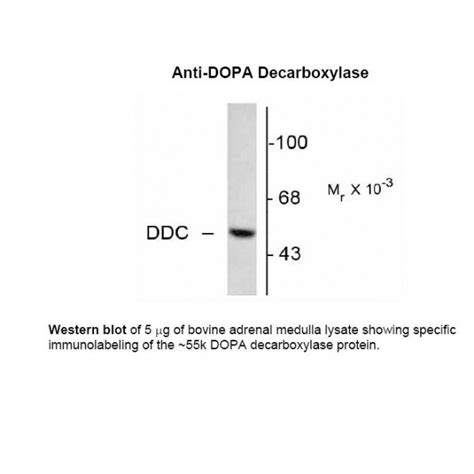 Buy Dopa Decarboxylase Antibody Axil Scientific