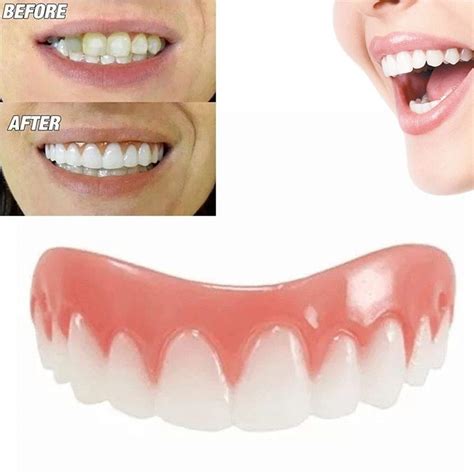 Removable Teeth Covers