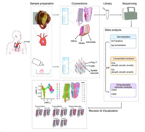 Study Design For St In Aortic Dissection Tissue Of Aortic Dissection