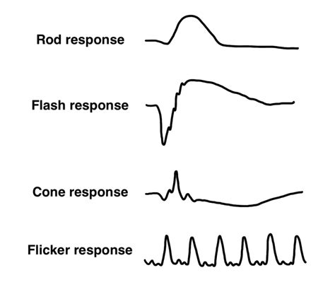 How To Read And Interpret Erg A Practical Guide To Electroretinography For Retinal Disease