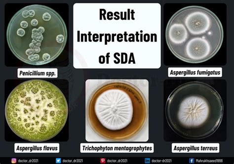 Result Interpretation On Sabouraud Dextrose Agar Sda Microbiology Fungi Medical School