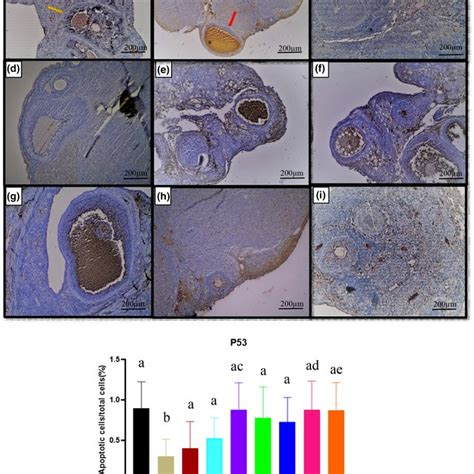 Localization Of Apoptosis With Ihc P53 Ihc Staining 10 Scale Bar Download Scientific