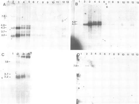 Developmental Northern Blots Showing Transcripts Detected By Probes A Download Scientific