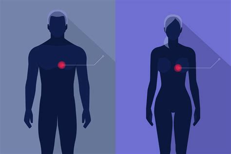 Heart Disease Men Vs Women