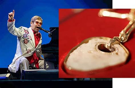 Elton John Has His Kneecaps Transformed Into Timeless Gold Jewelry
