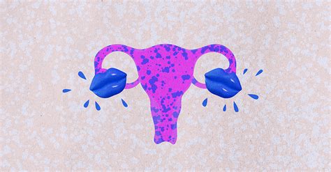 What It Means To Have Kissing Ovaries