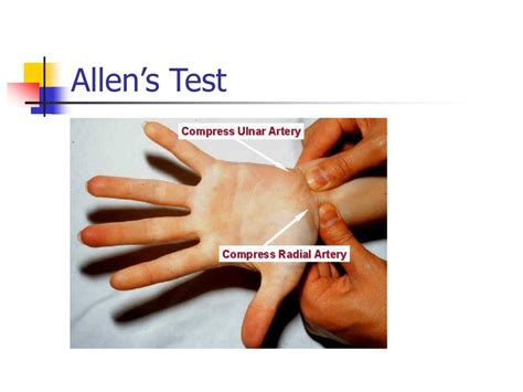 Ppt Acid Base Balance And Abg Interpretation Powerpoint Presentation