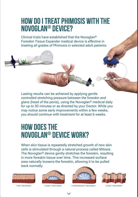 Phimosis Patient Handout