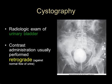 Chapter 18 The Urinary System 9910 Classroom Ed Ppt Video Online Download Chapter 18 The Urinary System 9910 Classroom Ed Ppt Video Online Download