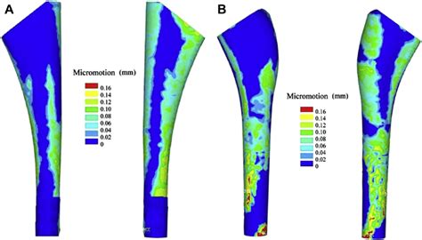 Micromotion Between The Bonestem Interface In A The N S Model And