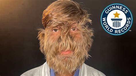 Indian Teen Sets Guinness World Record For Hairiest Face Afrogazette