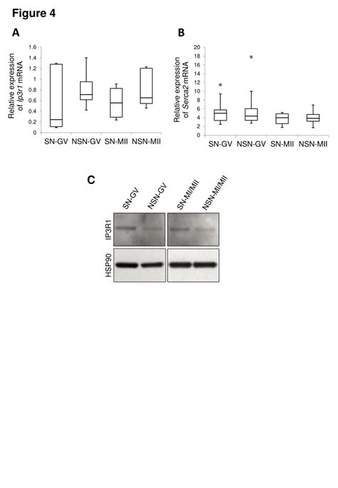 Expression Of Ip3r1 And Serca2 Relative Expression Of Ip3r1 A And Download Scientific