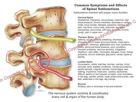 Common Effects Of Spinal Subluxation Chiropractic Poster Handout Digital Download Printable Wall
