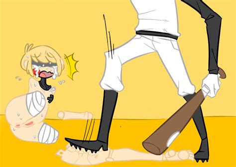 Rule 34 Amputated Amputation Amputee Anus Armless Ball Joints Crying