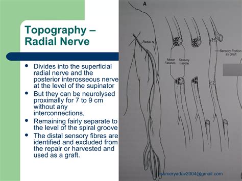 Radial Nerve Palsy Ppt