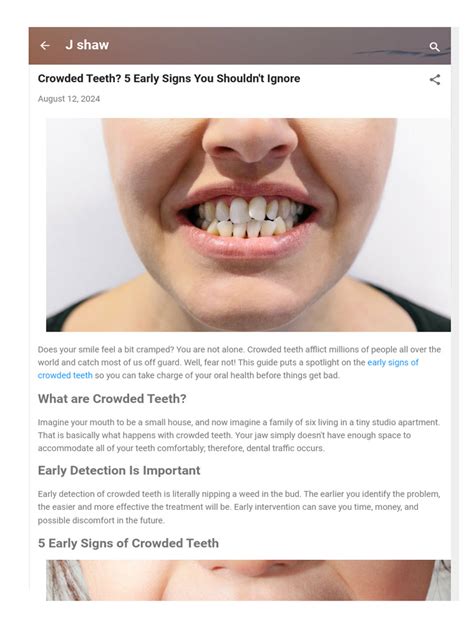 Early Signs Of Crowded Teeth Explained Pdf Human Tooth Mouth