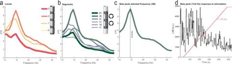 Sunderland Baker ♿️ On Linkedin Comparison Of Beta Peak Detection Algorithms For Data Driven