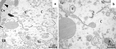 Electron Micrographics Of The Secretory Cells At The Post Secretory