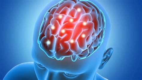 Brain Cyst Symptoms In Adults 10 Key Signs You Should Know