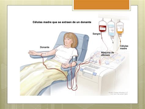 Aferesis En Medicina Transfusional