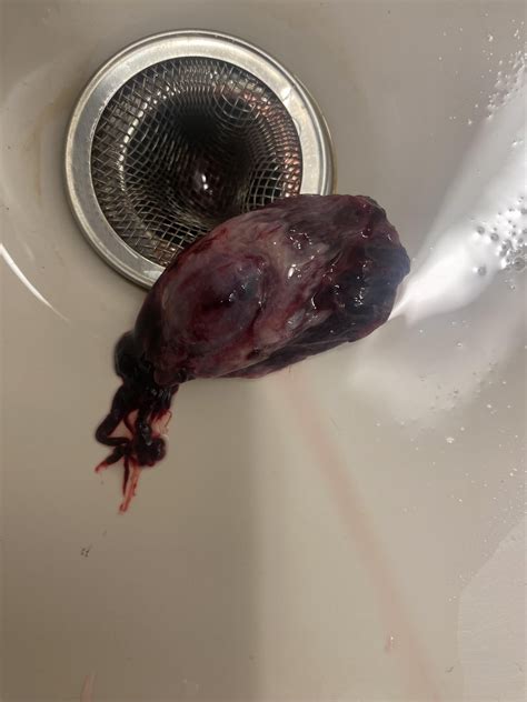 Why Does Sex Always Burn Before My Period Anyway To Avoid This R Periods