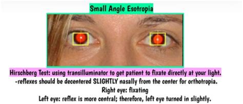 Why Two Eyes Part 2 Flashcards Quizlet