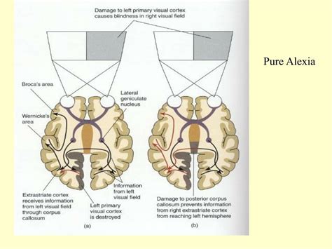 Ppt Brain Lateralization Vision And Sensorymotor Systems That Why