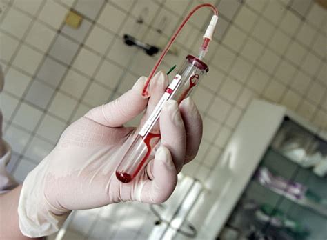 The Device Detects Bacteria In The Body In Just A Few Minutes