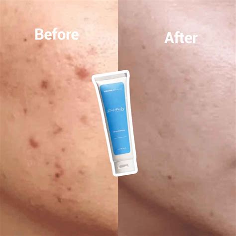 Cleanser Before After Nirvana Botanics