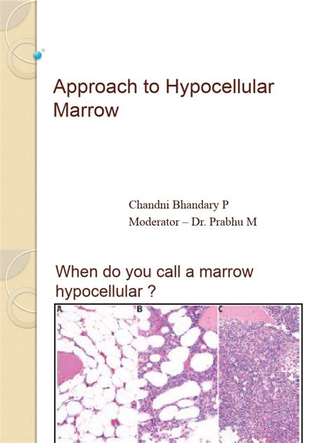 Approach To Hypocellular Marrow Pdf Anemia Blood