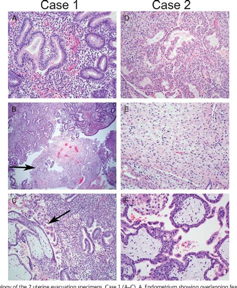 Figure 1 From Applications Of Str Genotyping In Surgical Pathology