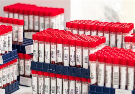 Pruebas Reales De Pcr Molecular De Hisopos Nasales Orofaríngeos Con