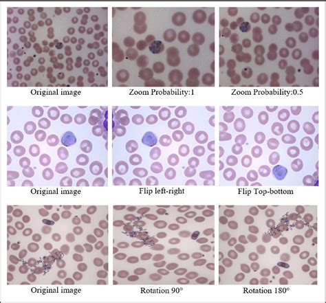Figure 5 From An Automated Malaria Cells Detection From Thin Blood