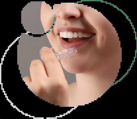 Best Tmj Specialist In Chennai Best Tmj Splints In Chennai Best Tmj Specialist In Chennai Best Tmj Splints In Chennai