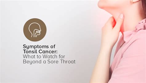 Tonsil Cancer Signs