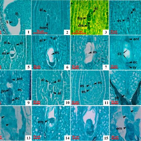 Longitudinal Sections Of Ovules Showing Apomictic Embryo Sac