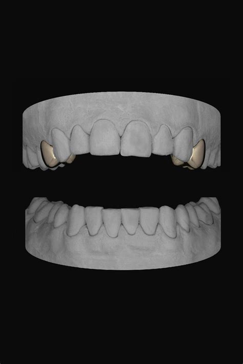 Premolar Premolar K9grillzuk