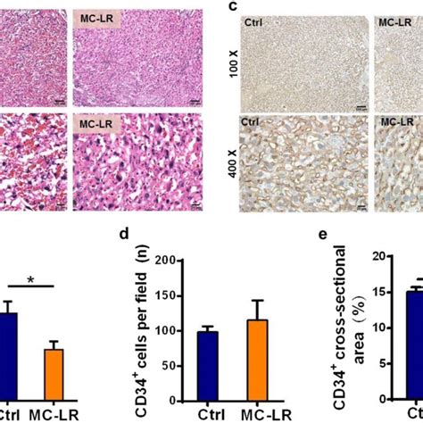 The Effect Of Paternal Mc Lr Exposure On Fetal Weight And Crown Rump Download Scientific