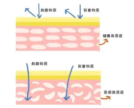 皮肤角质层薄，泛红怎么办？ 伊的家