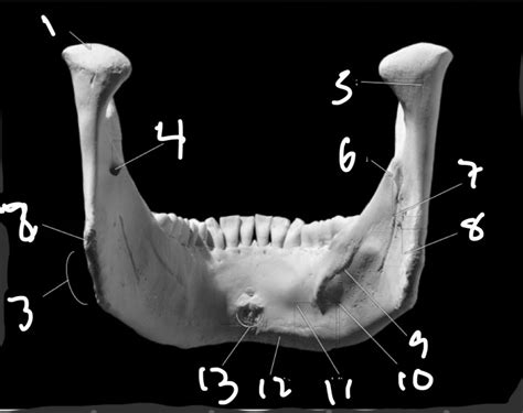 Diagram Of Mandible Bone Features Part 2 Quizlet