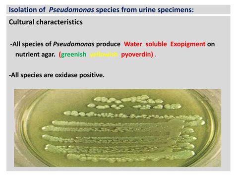Ppt Urinary Tract Infection Uti Powerpoint Presentation Free