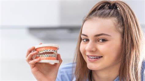 Foods To Avoid With Braces The Ultimate Guide In 2026