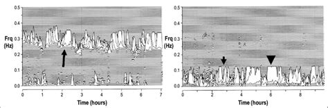The Ecg Derived Sleep Spectrogram The Left Part Of The Figure Shows A Download Scientific