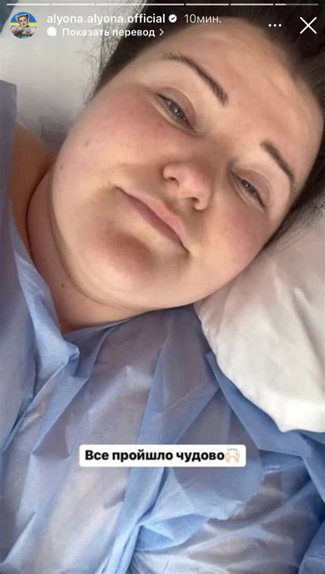 Alyona Alyona перенесла дві операції та розповіла про своє самопочуття