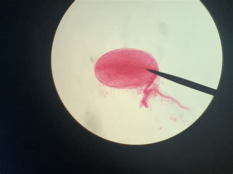 Lamellated Pacinian Corpuscle Diagram Quizlet